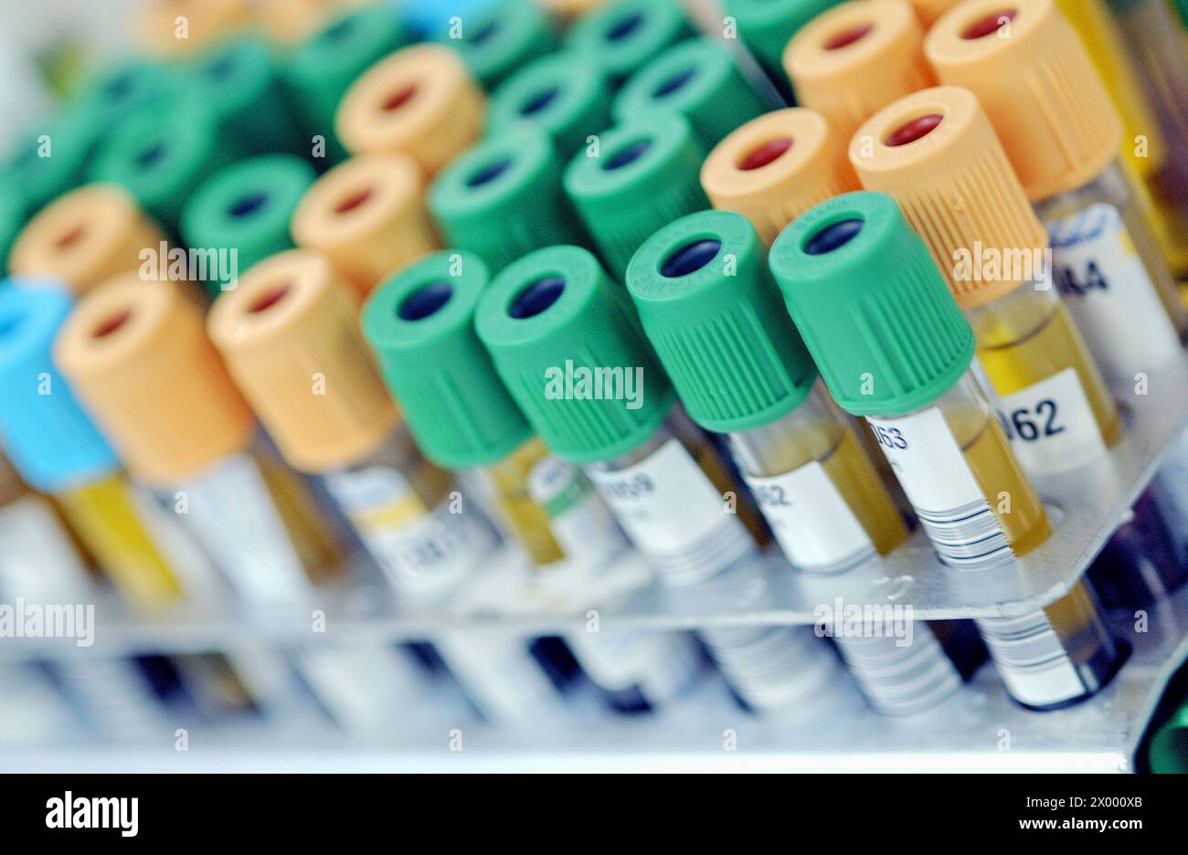 Detail blood samples tubes hi-res stock photography and images - Alamy