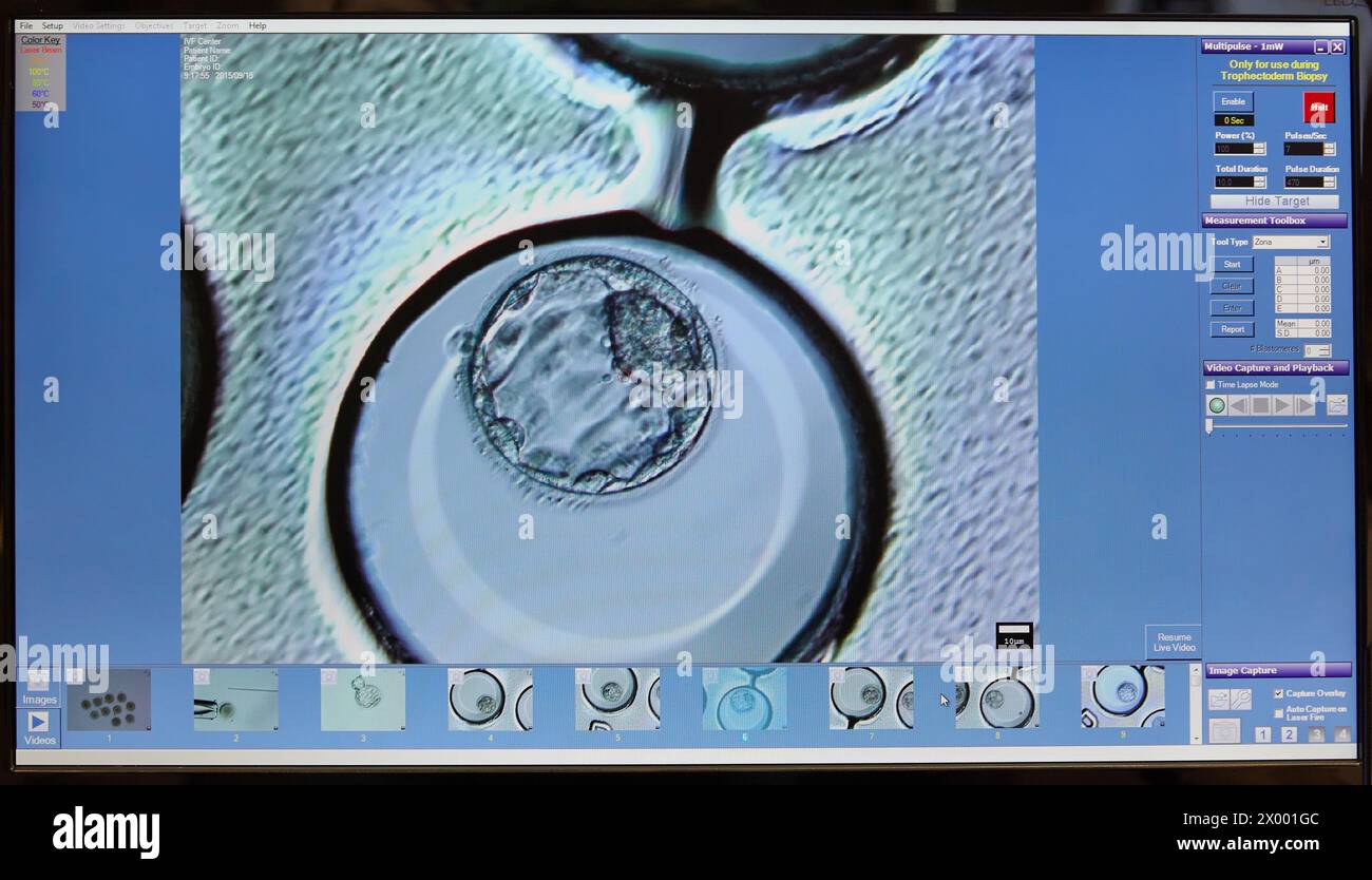 Foetus reproduction hi-res stock photography and images - Alamy