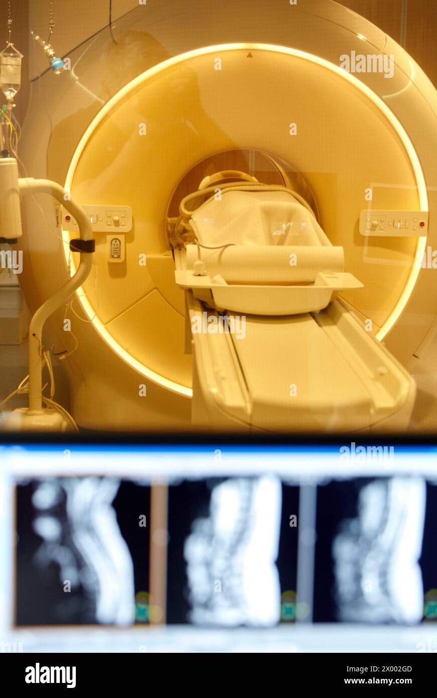 MRI scan, NMR (Nuclear Magnetic Resonance), medical imaging for diagnosis, Hospital Donostia ...