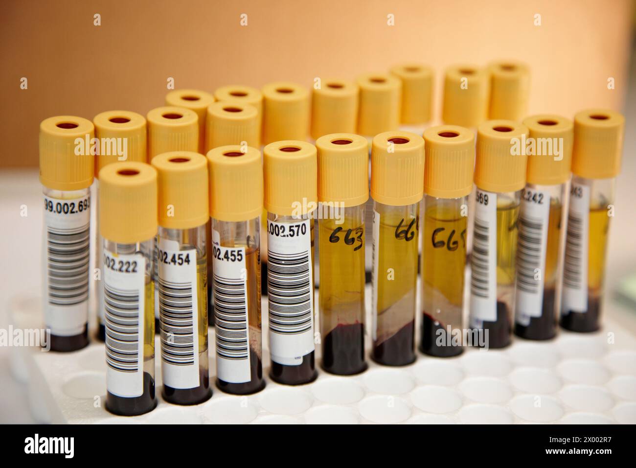 Blood samples for biobank hi-res stock photography and images - Alamy