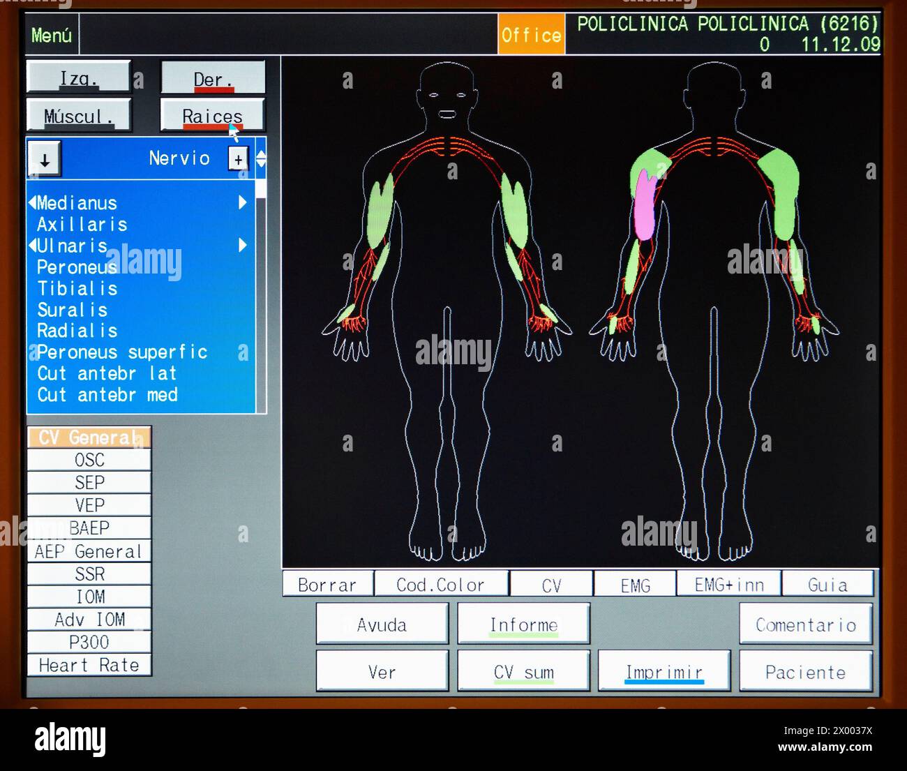 Neurophysiology hi-res stock photography and images - Alamy