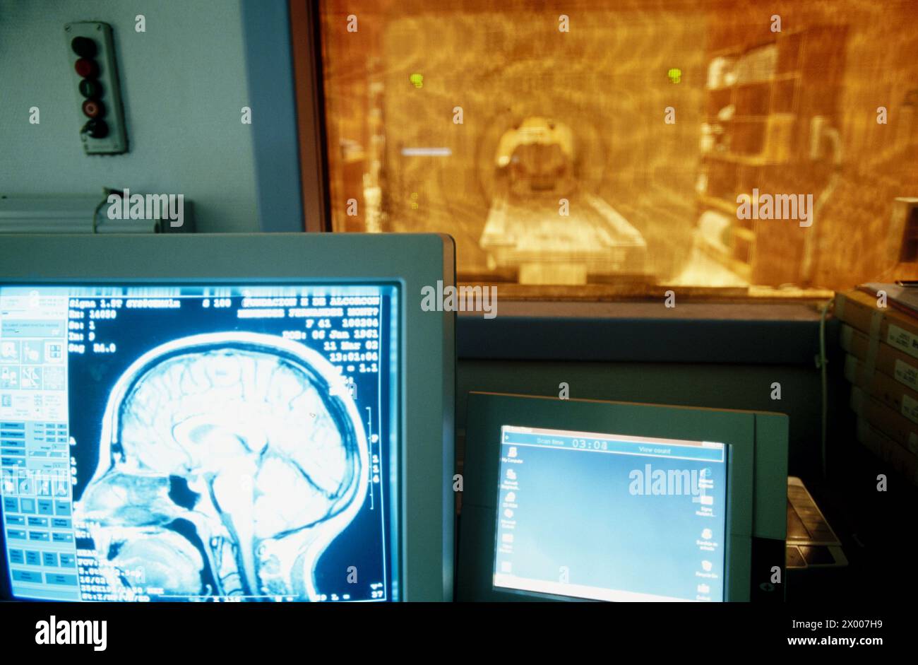 Magnetic Resonance Scan Stock Photo - Alamy
