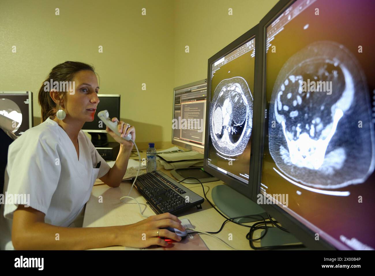 Abdominopelvic CT scan, Radiology Interpretation Review, Radiology ...