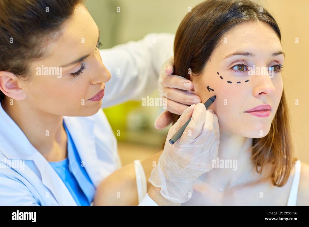 Facelift. Blepharoplasty. Surgery that aims to rejuvenate the look. It ...