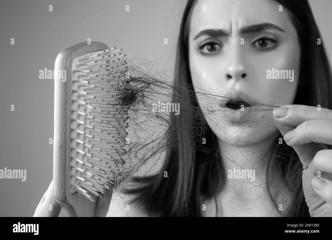 Hair loss. Woman is upset of hair loss. Portrait of sad girl with ...