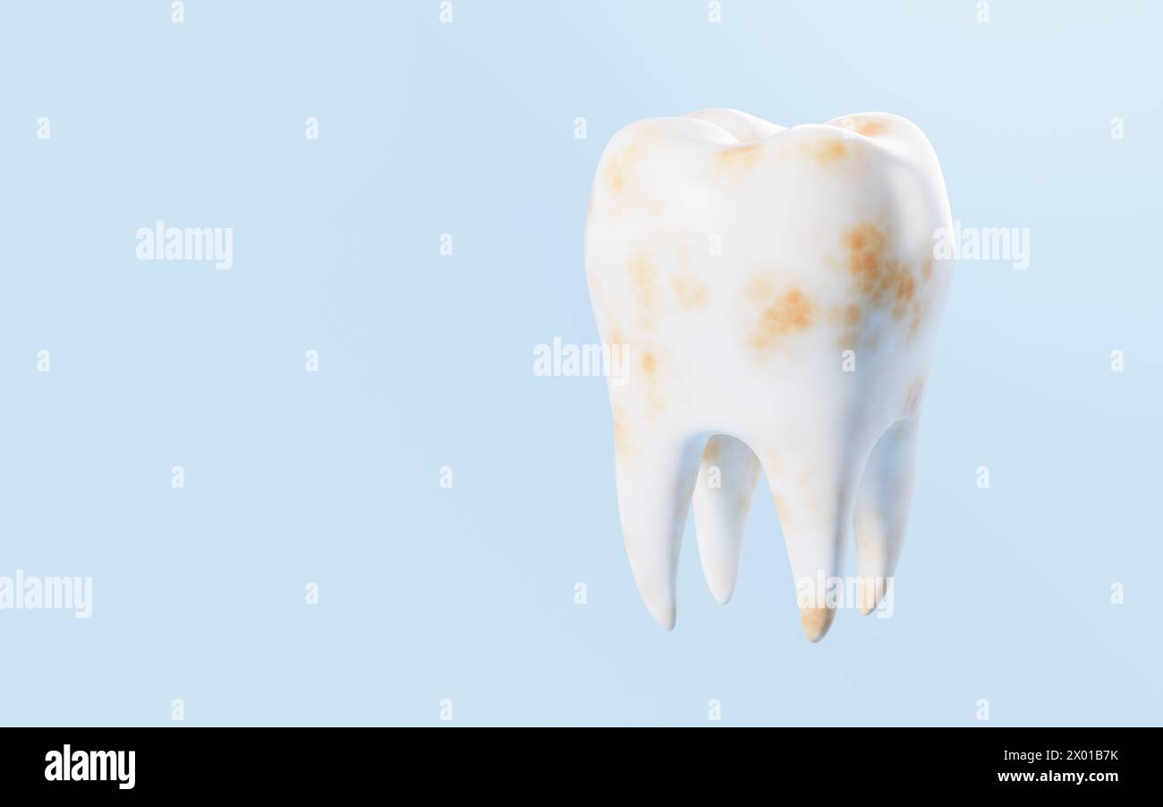 Human tooth model, tooth with plaque, unhealthy tooth, 3d rendering. 3d ...