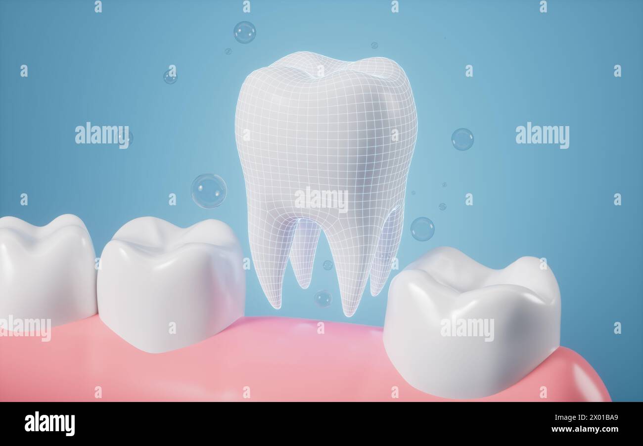 Human tooth model, tooth implantation, orthodontics, 3d rendering. 3d ...