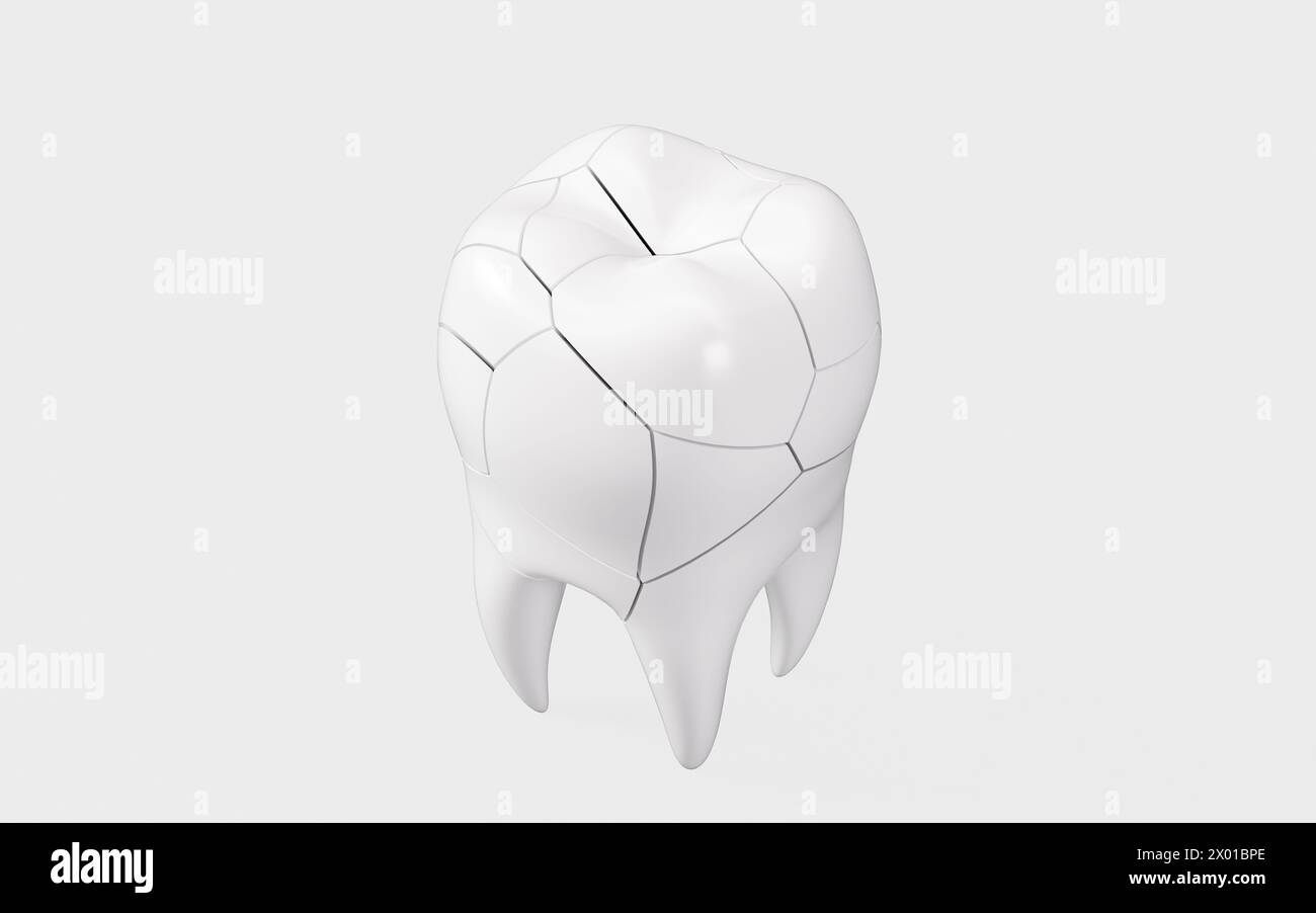 Human tooth model, tooth cracking, oral rehabilitation, 3d rendering ...