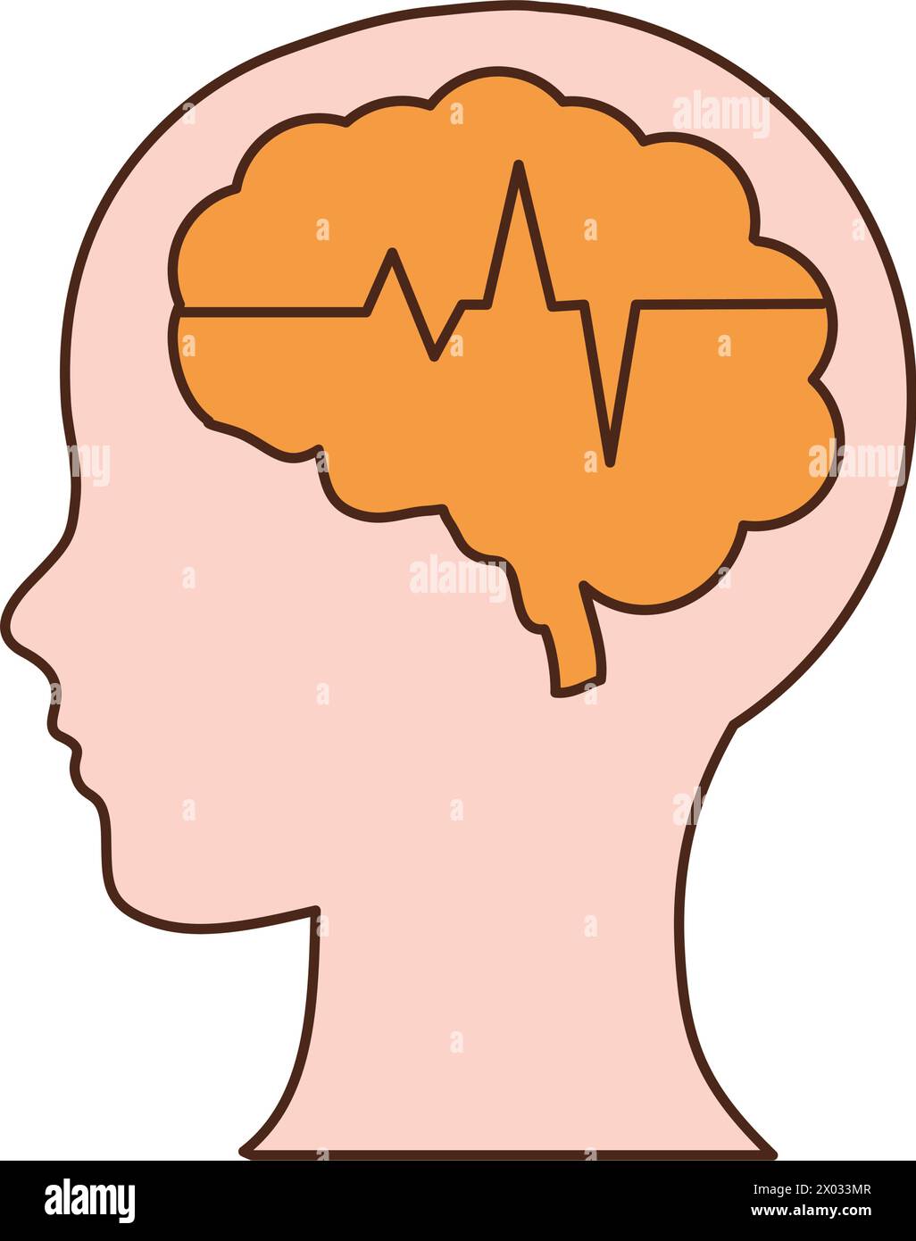 parkinson neurological disorder Stock Vector Image & Art - Alamy