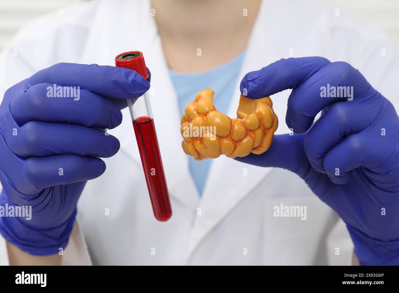 Endocrinologist showing thyroid gland model and blood sample in test ...