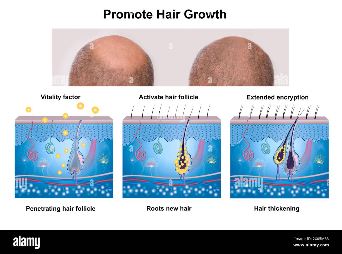 Hair growth phase, anatomy diagram of human hair. AD for oil or serum ...