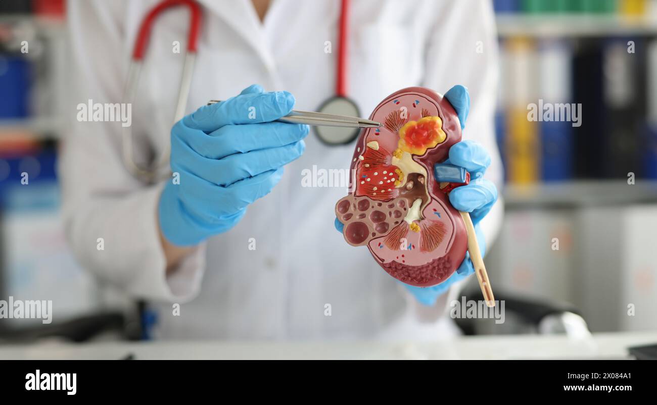 Urology and treatment of kidney diseases closeup Stock Photo - Alamy
