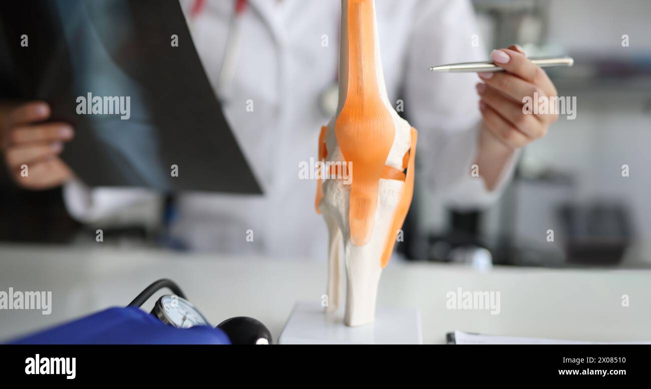 Doctor shows anatomy knee joint hi-res stock photography and images - Alamy
