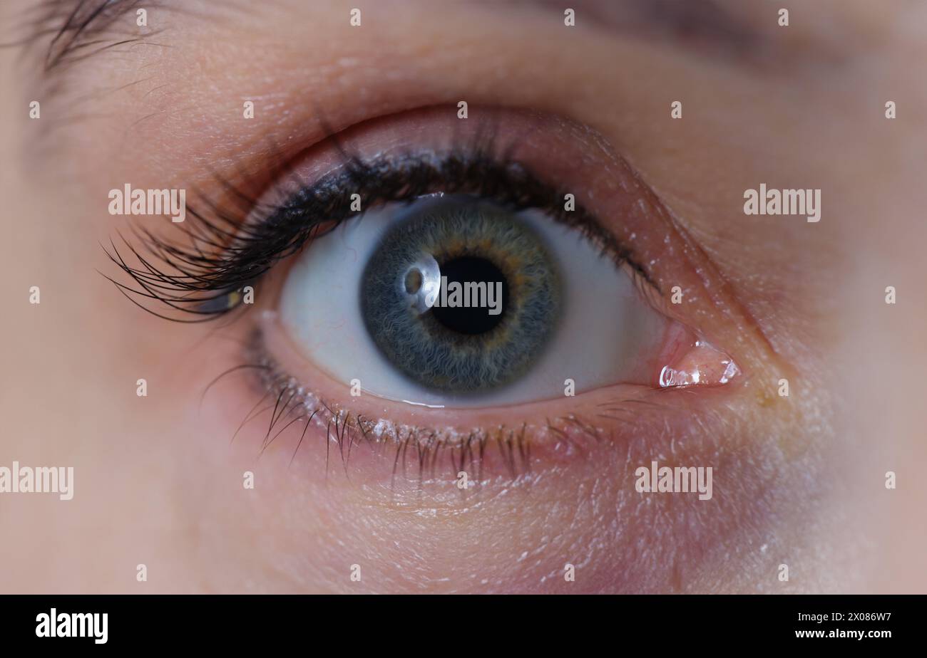 Wide open female eye with gray green pupil and a permanent arrow on ...