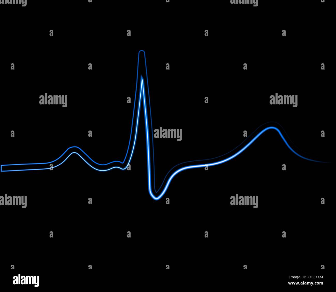 Vector isolated illustration of electrocardiogram with neon effect ...