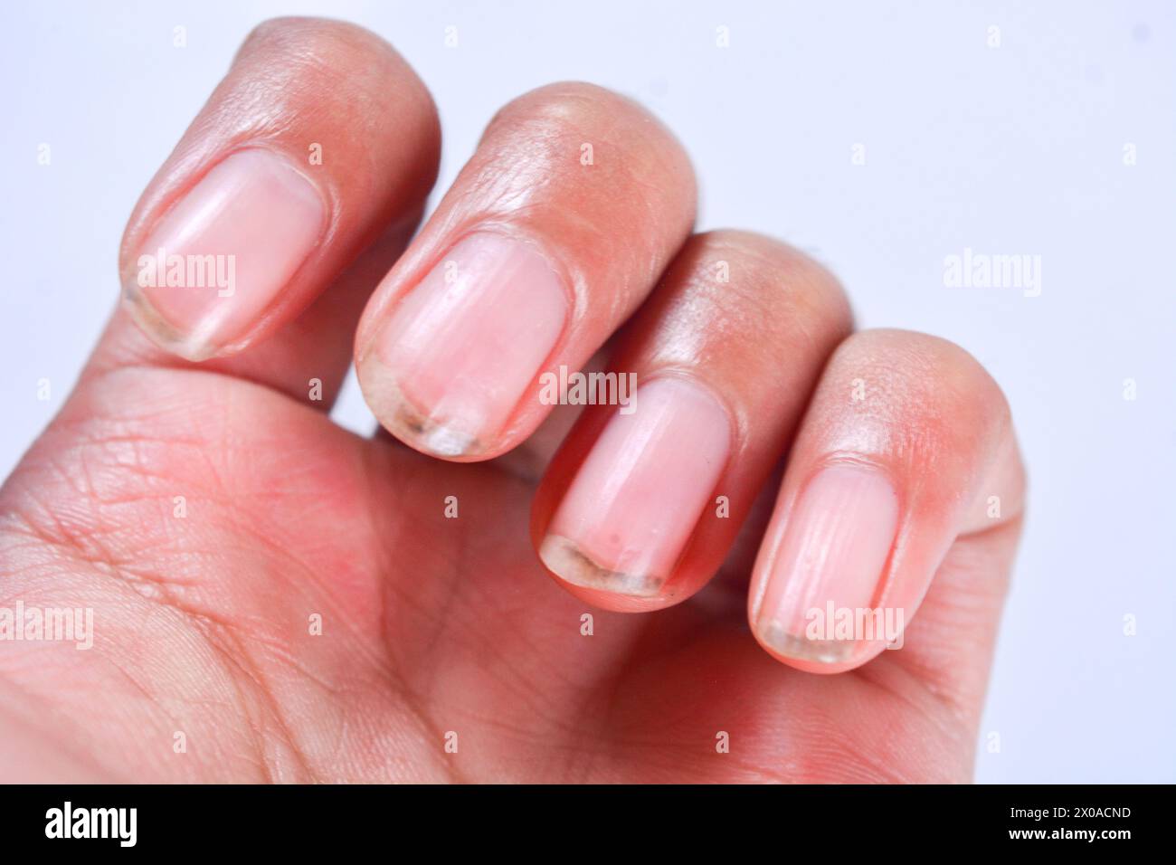 Dirty fingernails hi-res stock photography and images - Alamy