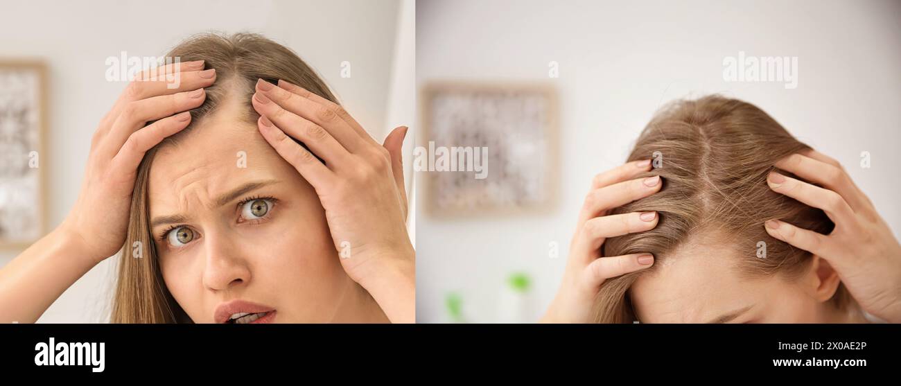 Woman before and after hair treatment with high frequency darsonval ...