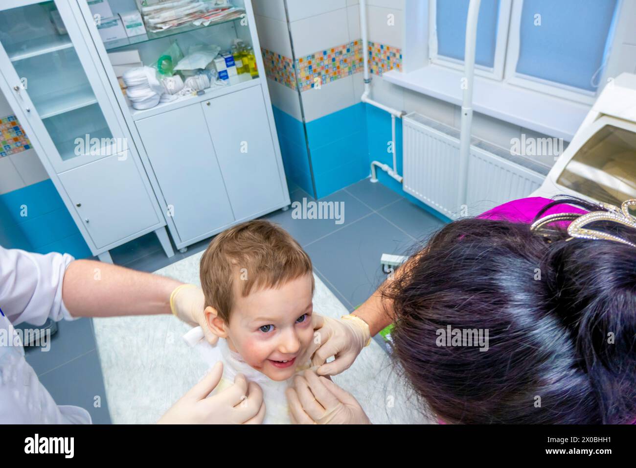 medical procedure dressing a boy with a first-degree burn from boiling ...