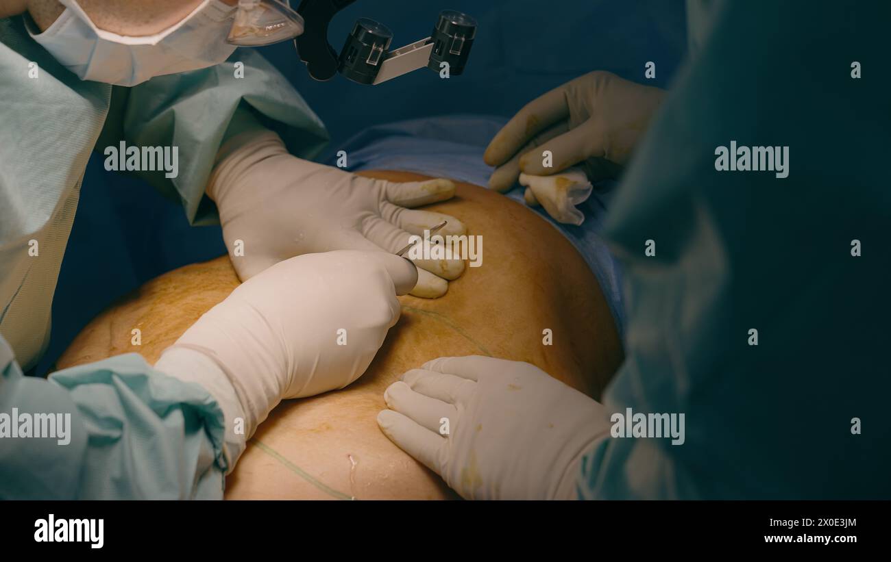Two Men Doctors Surgeon Physician Hands Cut Scalpel Make Incision On 2976