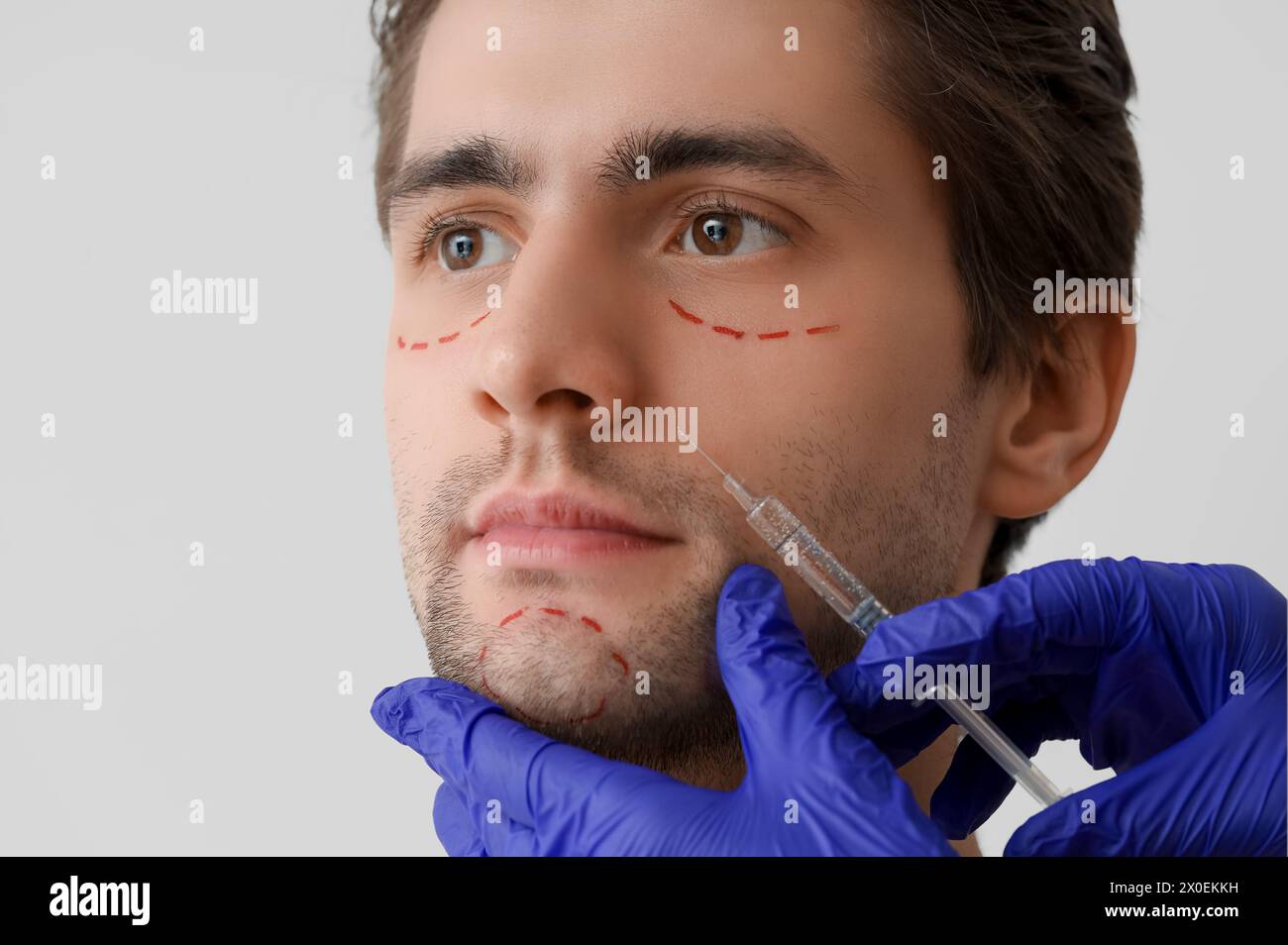 Plastic surgeon with syringe and markings on young man's face against ...