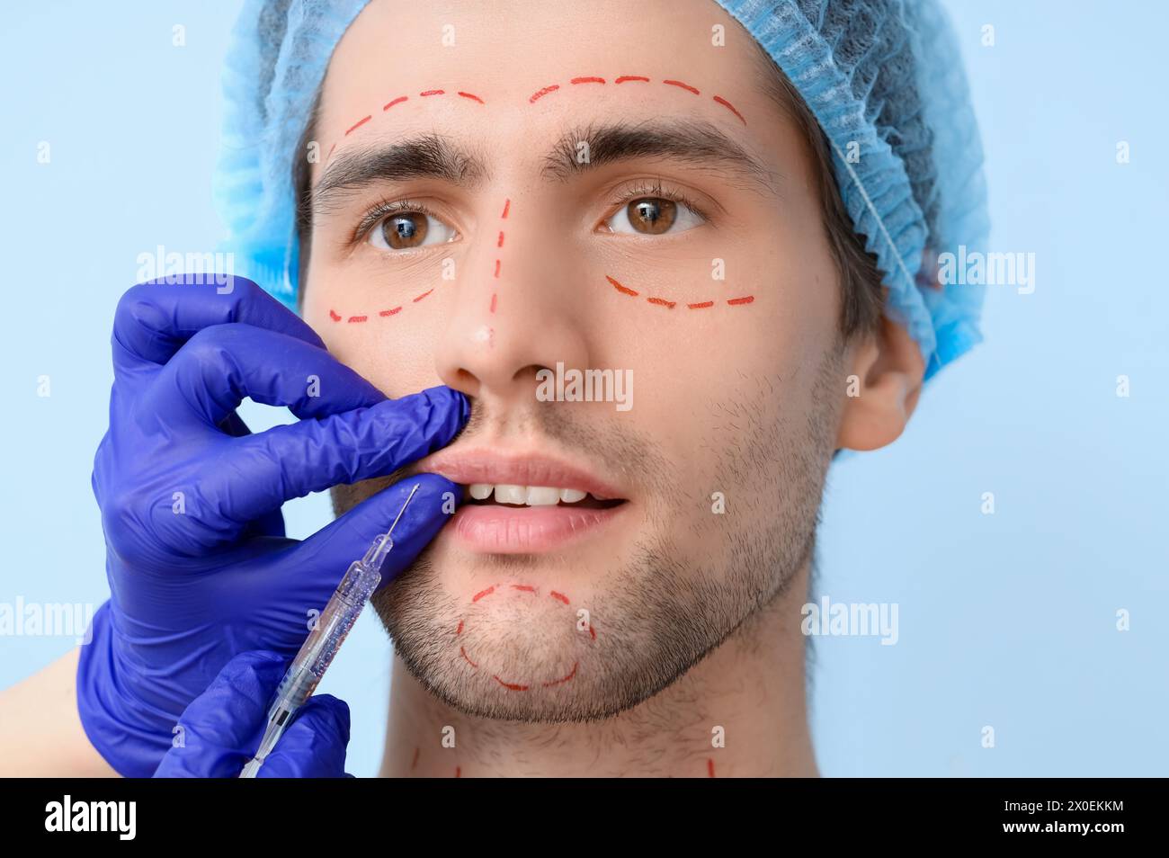 Young man with marked face receiving lip injection on blue background ...