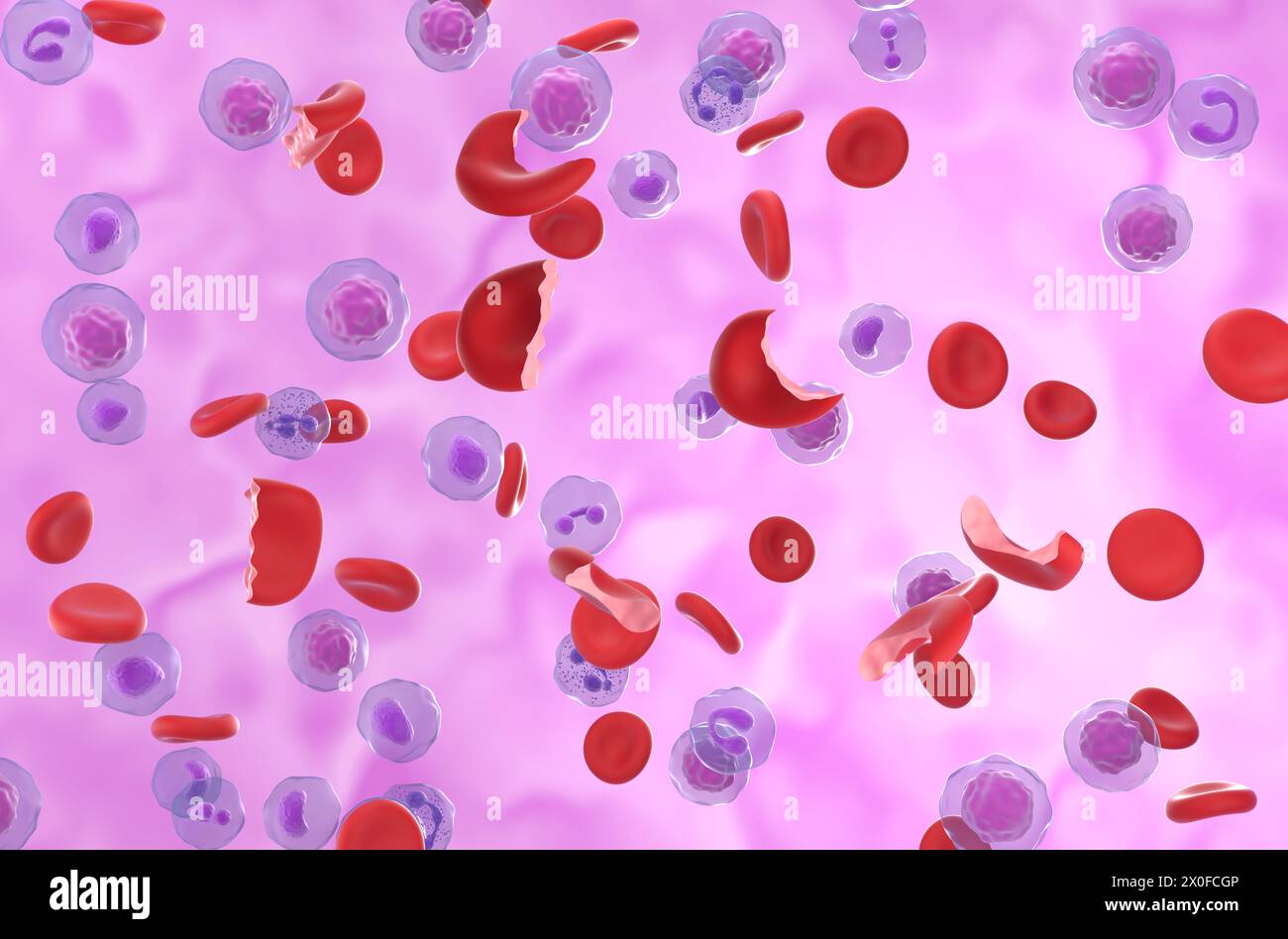 Hemolytic Anemia (HA) cells in the blood flow - isometric view 3d ...
