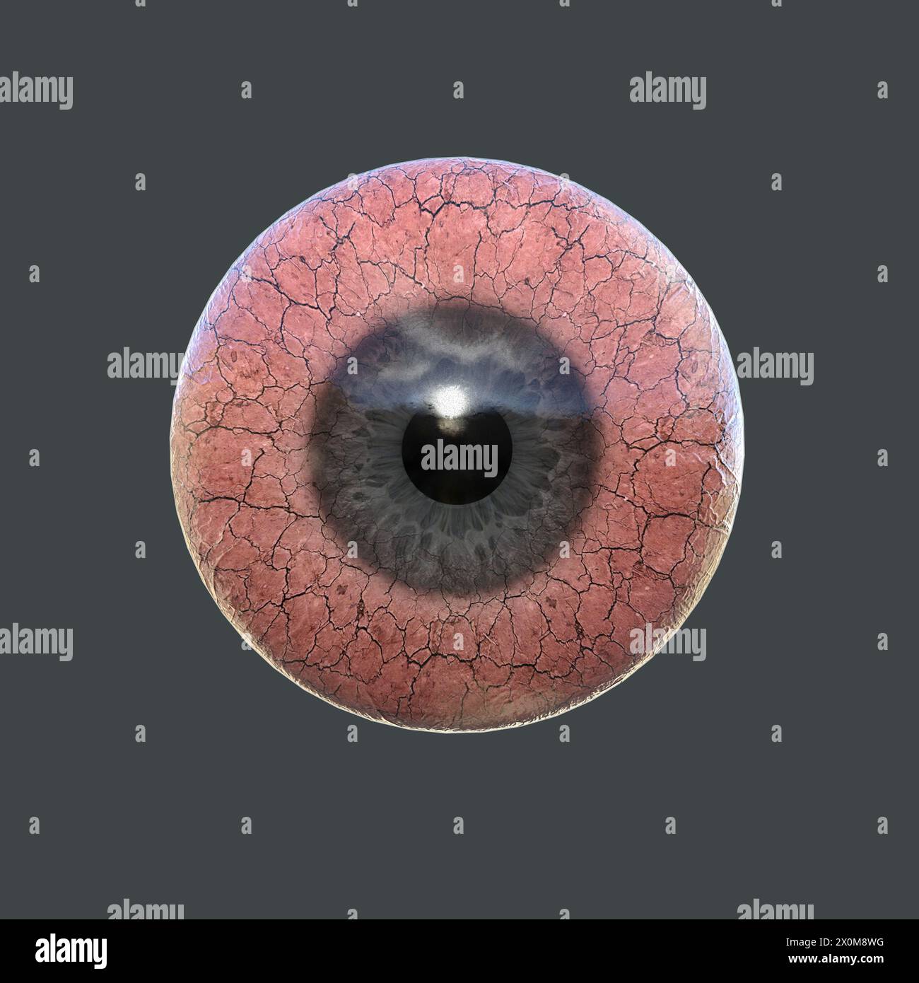 Conceptual illustration portraying dry eye as a cracked desert ground ...