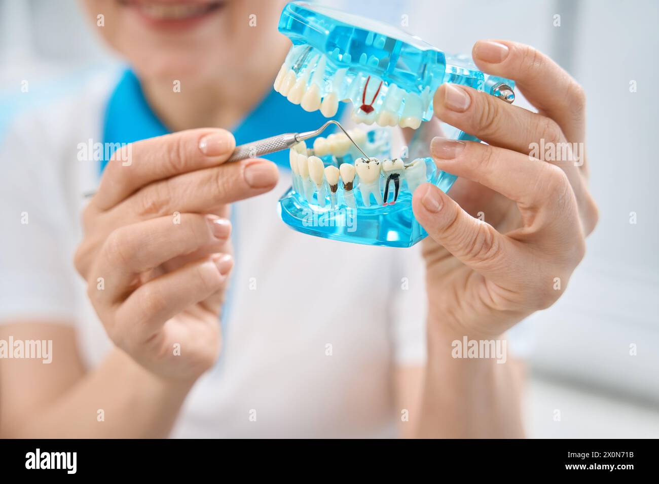 Female dental technician showing tooth with caries or decay on 3d model ...
