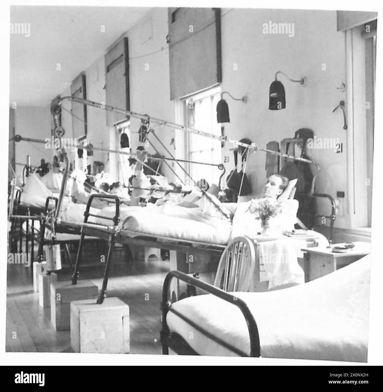 Cambridge Hospital Aldershot Treatment Of Fractures Extension For A