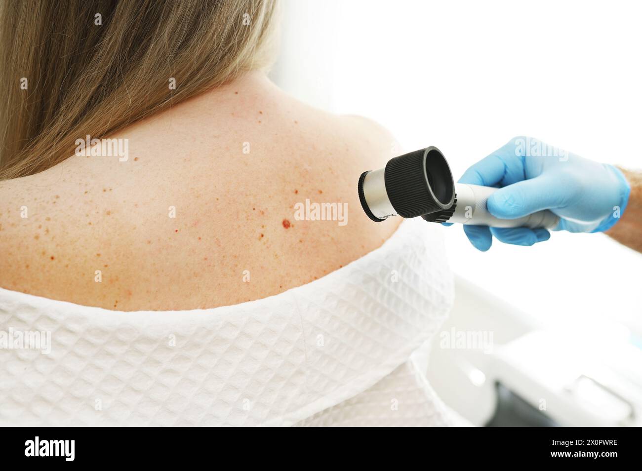 a dermatologist examines moles and skin growths on the patient's body ...