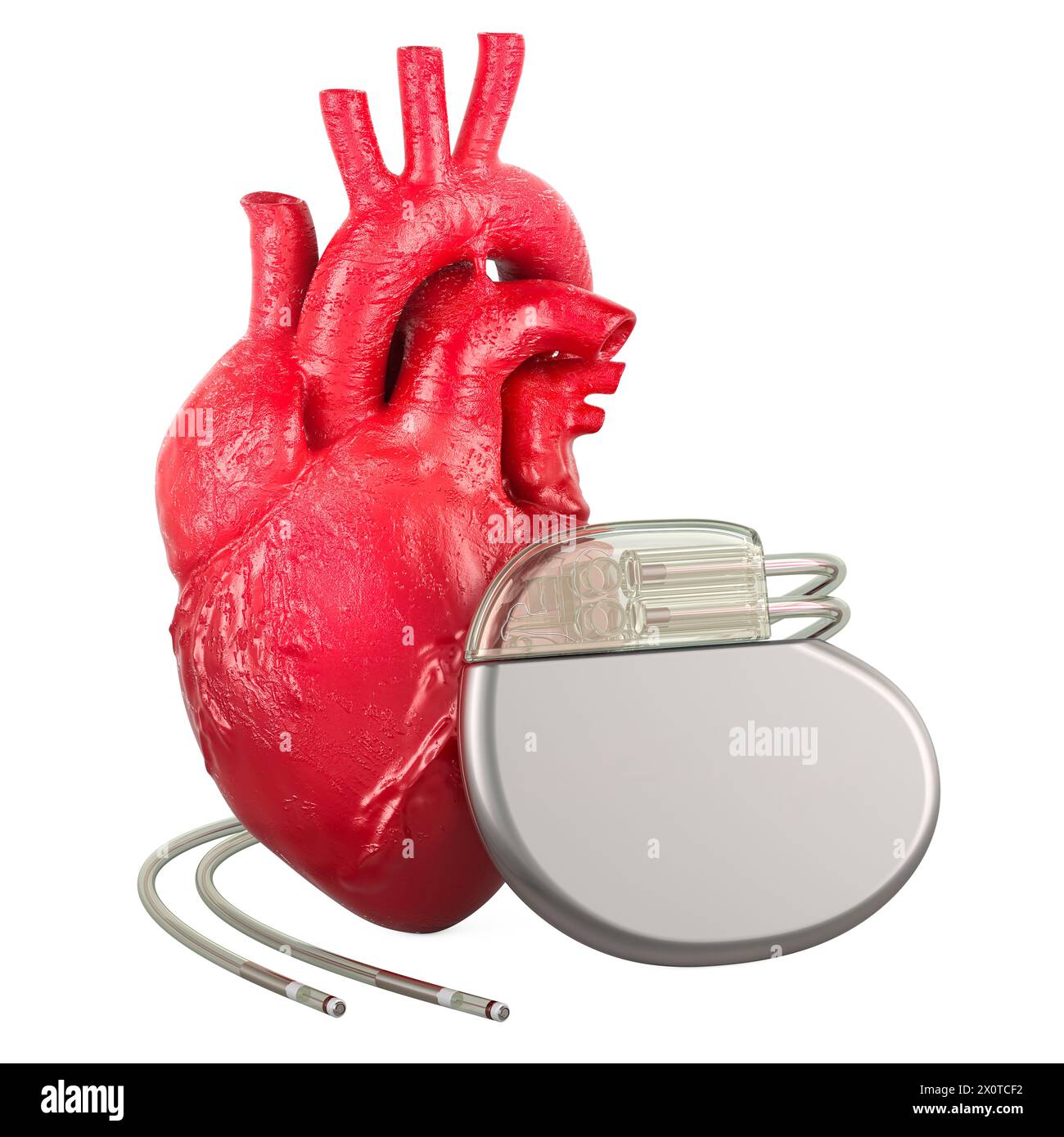 Human heart with Implantable Cardiac Device, 3D rendering isolated on ...
