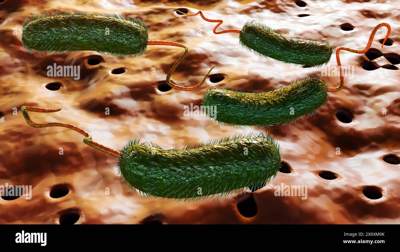Sepsis skin hi-res stock photography and images - Alamy