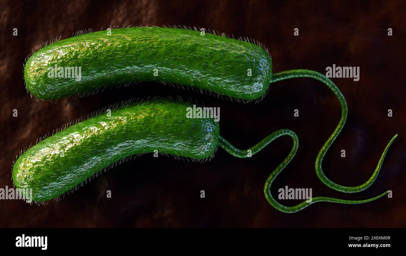 Sepsis skin hi-res stock photography and images - Alamy