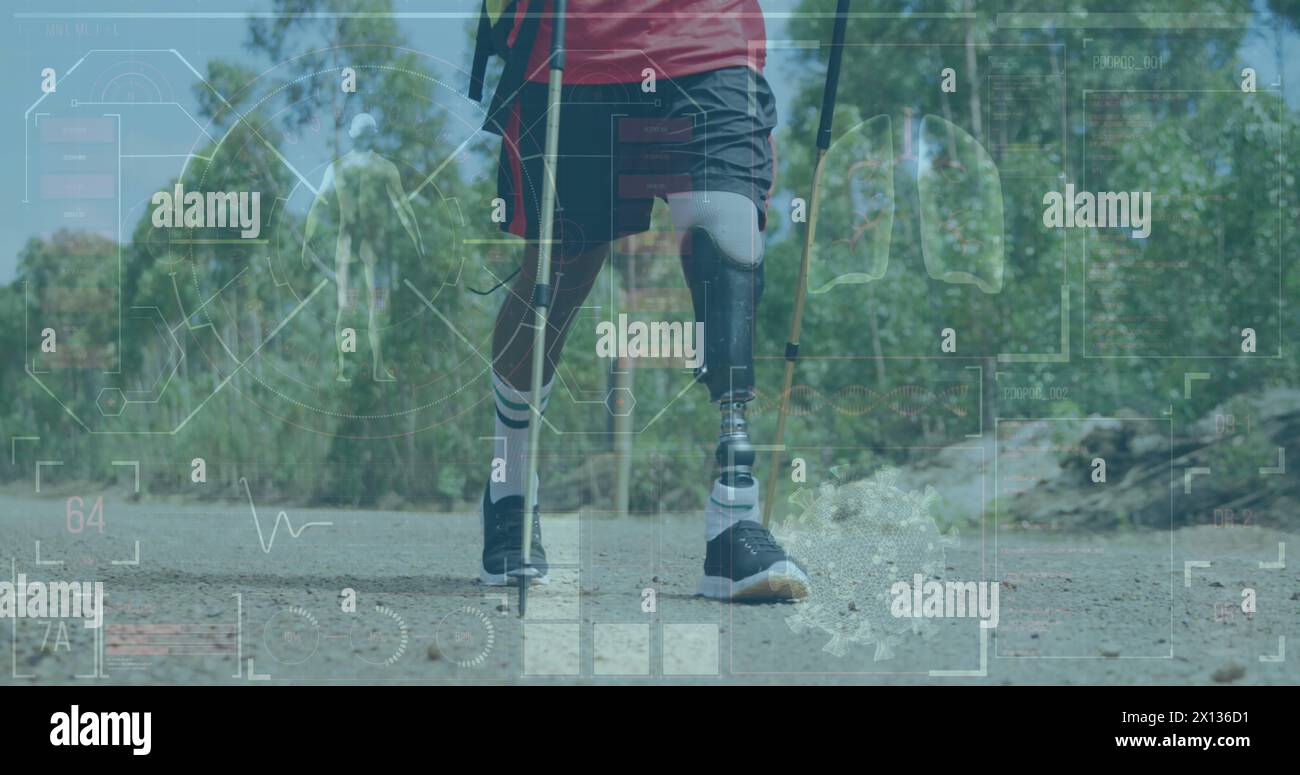 Prosthetic advancements hi-res stock photography and images - Alamy