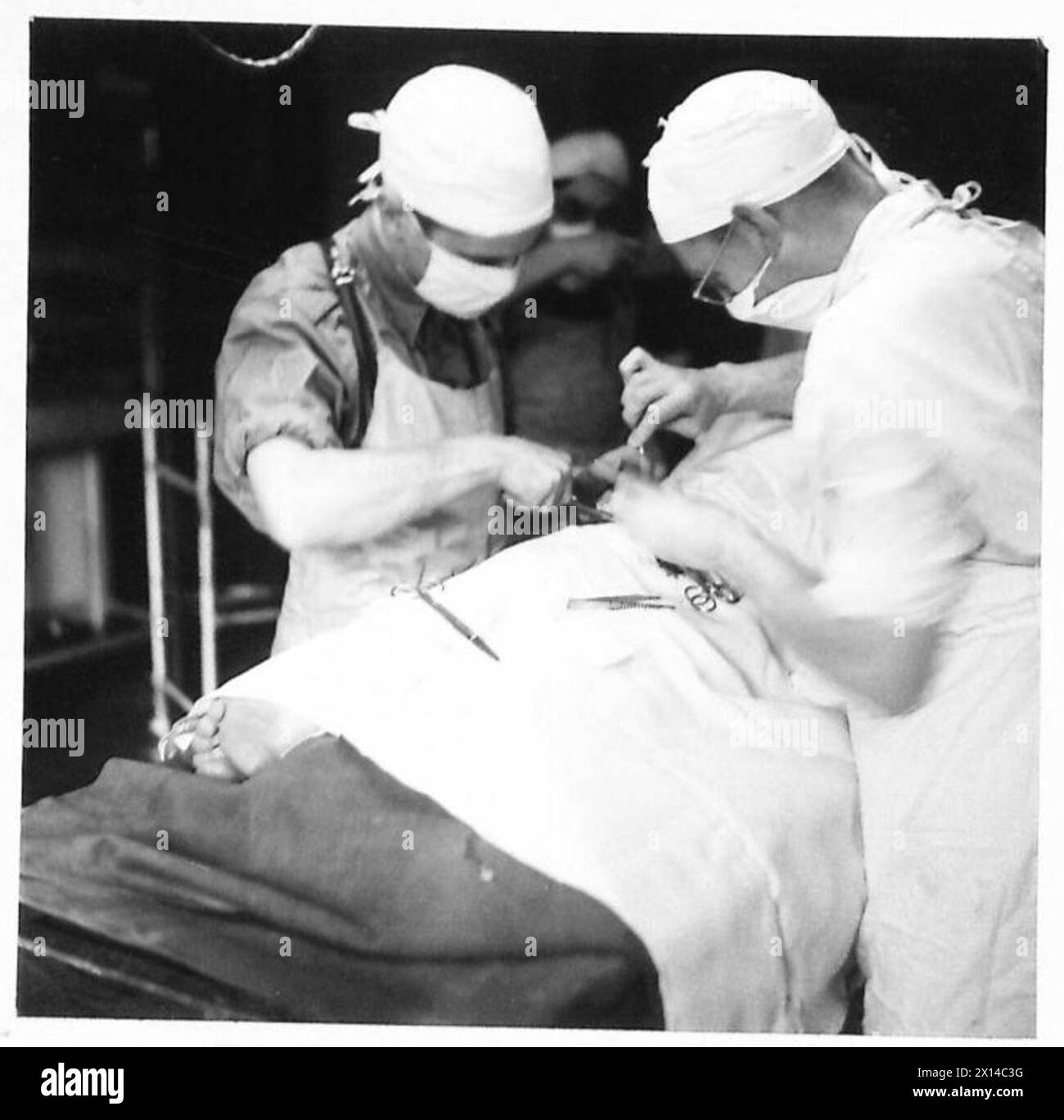 THE PRICE OF VICTORY - During an operation, showing the patient's leg ...