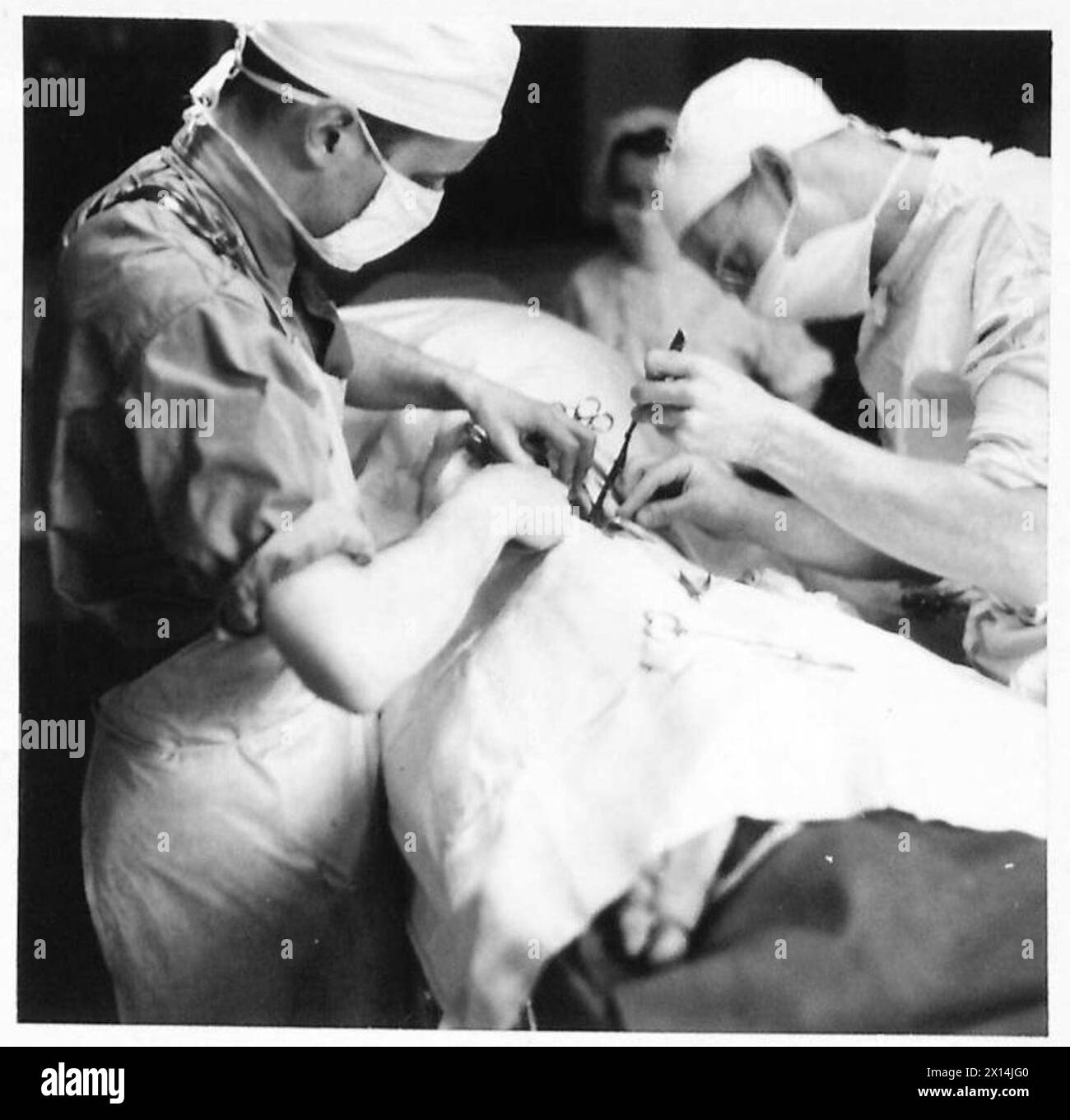 THE PRICE OF VICTORY - During an operation, showing the patient's leg ...