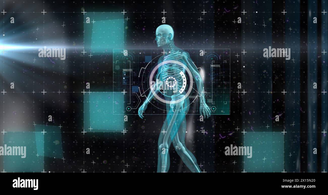 Image of scope scanning, markers and data processing over human body ...
