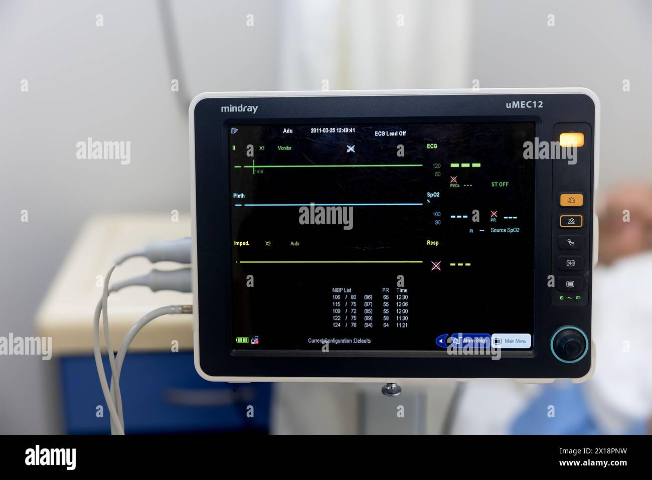 Denizli, Turkey - 28 February 2024; Monitor screen with vital sign and ...