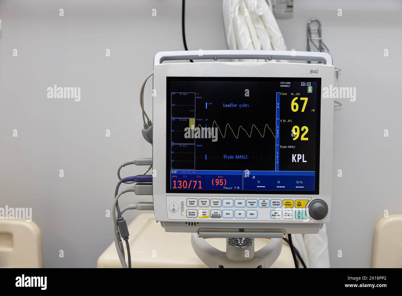 Denizli, Turkey - 28 February 2024; Monitor screen with vital sign and ...