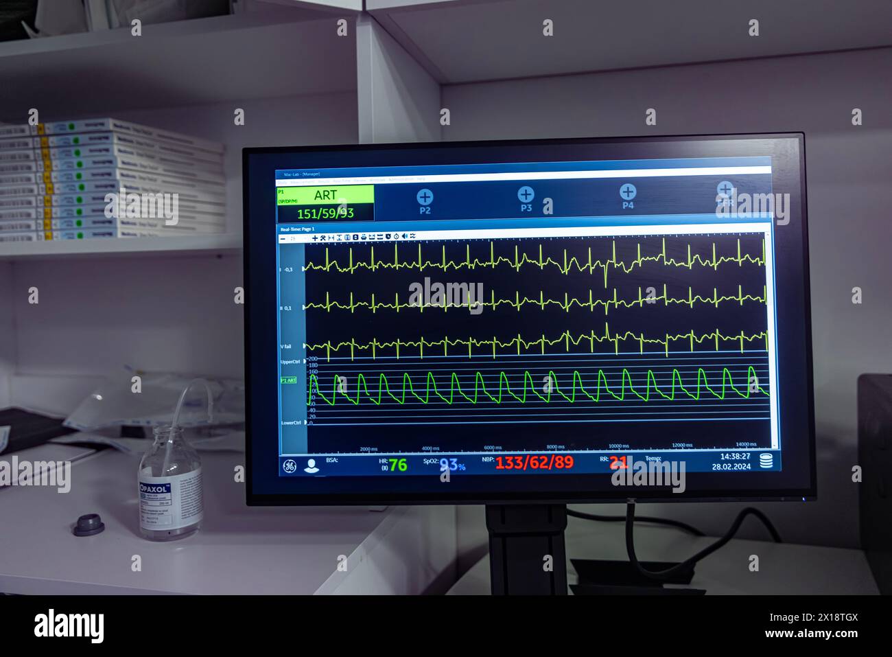 Denizli, Turkey - 28 February 2024; Monitor screen with vital sign and ...