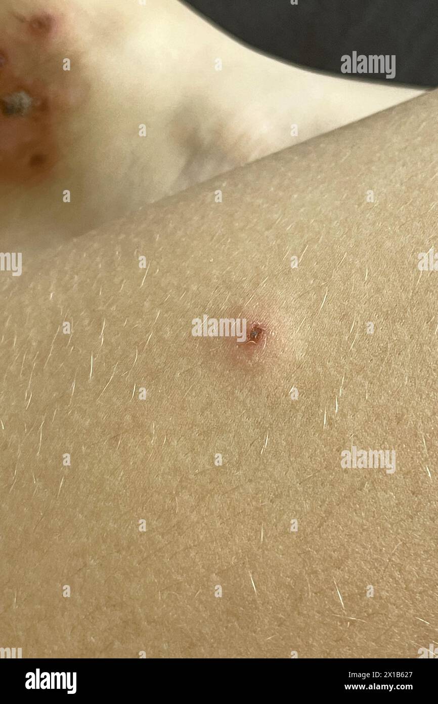 Dermatology, medicine and health care concept. Human skin closeup ...