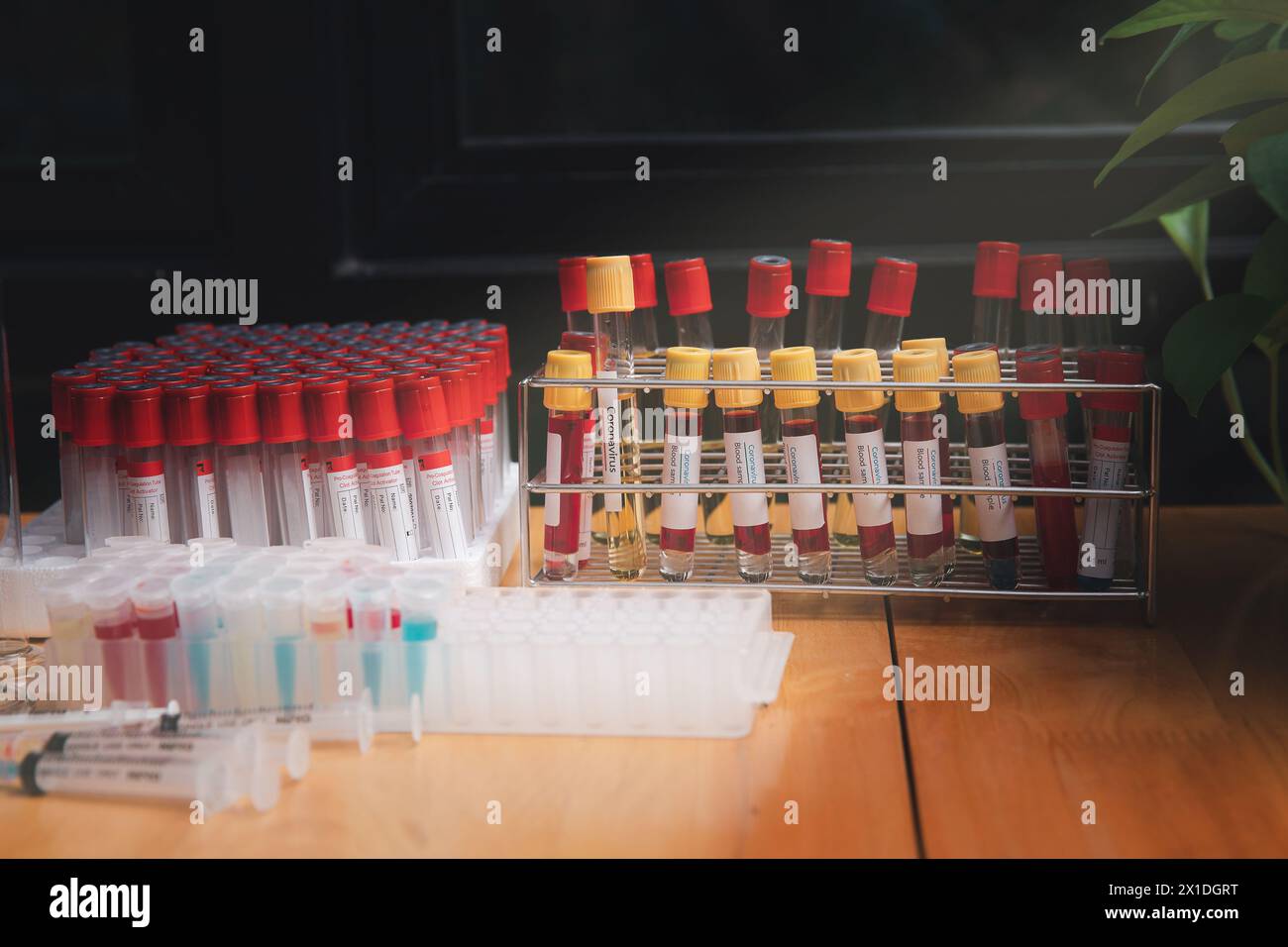 Blood samples and plasma in tubes on work table in a medical ...