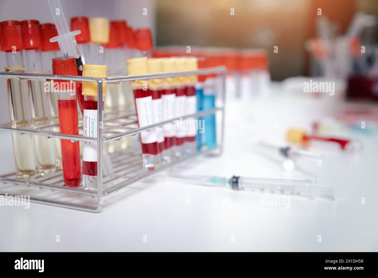 Blood samples in tubes and syringes on work table in a medical ...