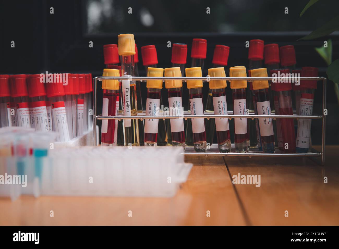 Blood samples and plasma in tubes on work table in a medical ...