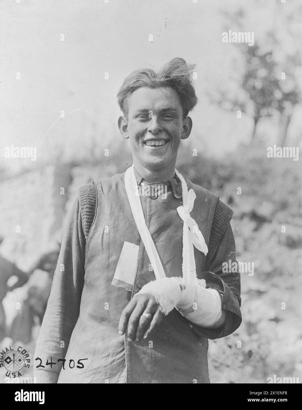 A wounded but happy soldier with his arm in a sling with the 27th ...