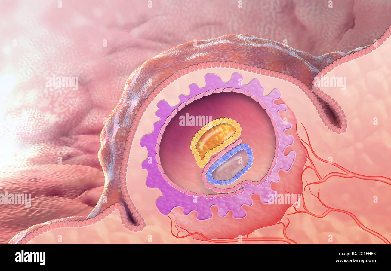 Illustration of a human blastocyst implanted in the lining (endometrium ...
