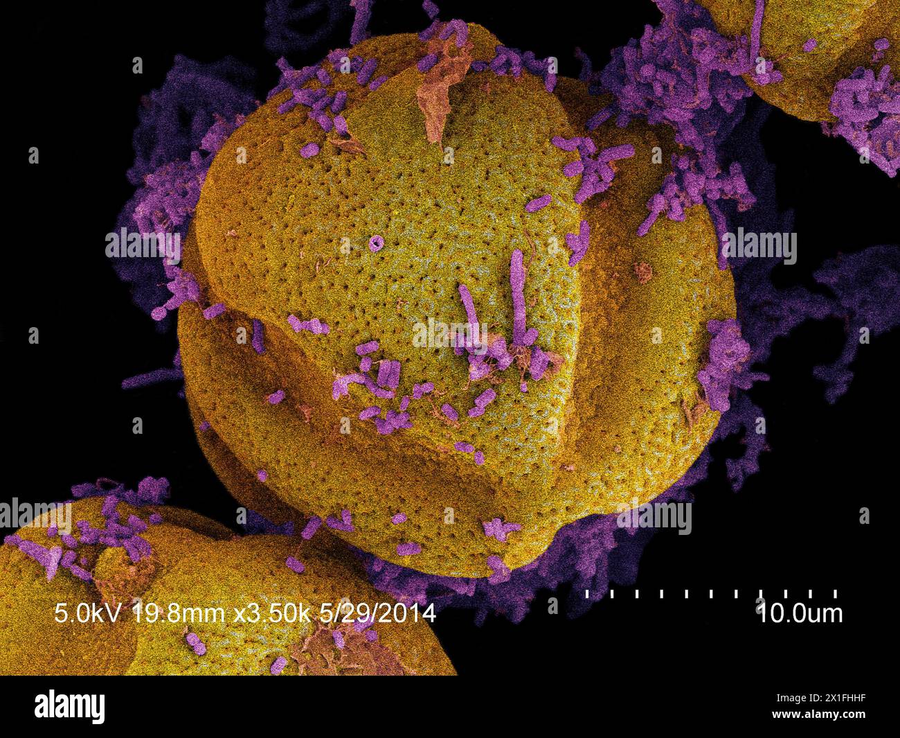 Coloured scanning electron micrograph (SEM) of bacteria (purple) on ...