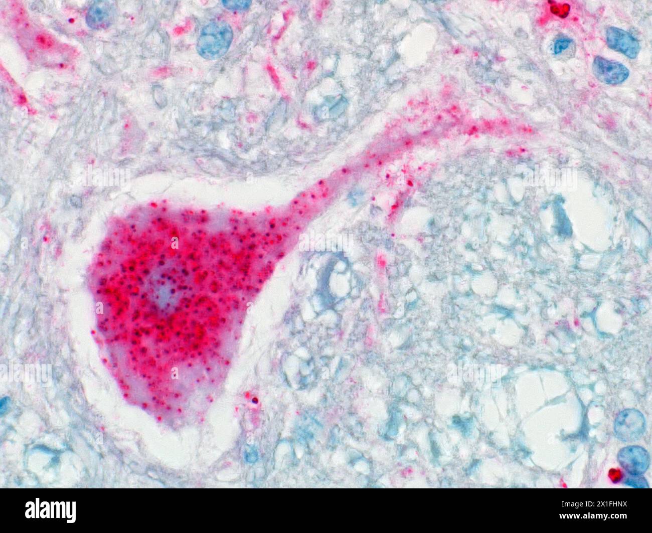 Light micrograph image of a neuron in the brain of a goat (Capra hircus ...