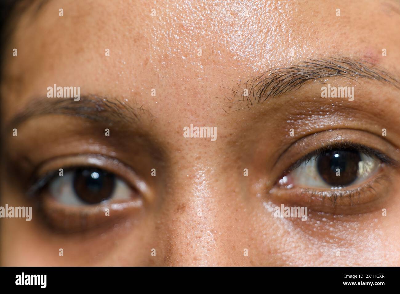 Close-up photo of a mature woman's eyes with laugh lines and crow's ...