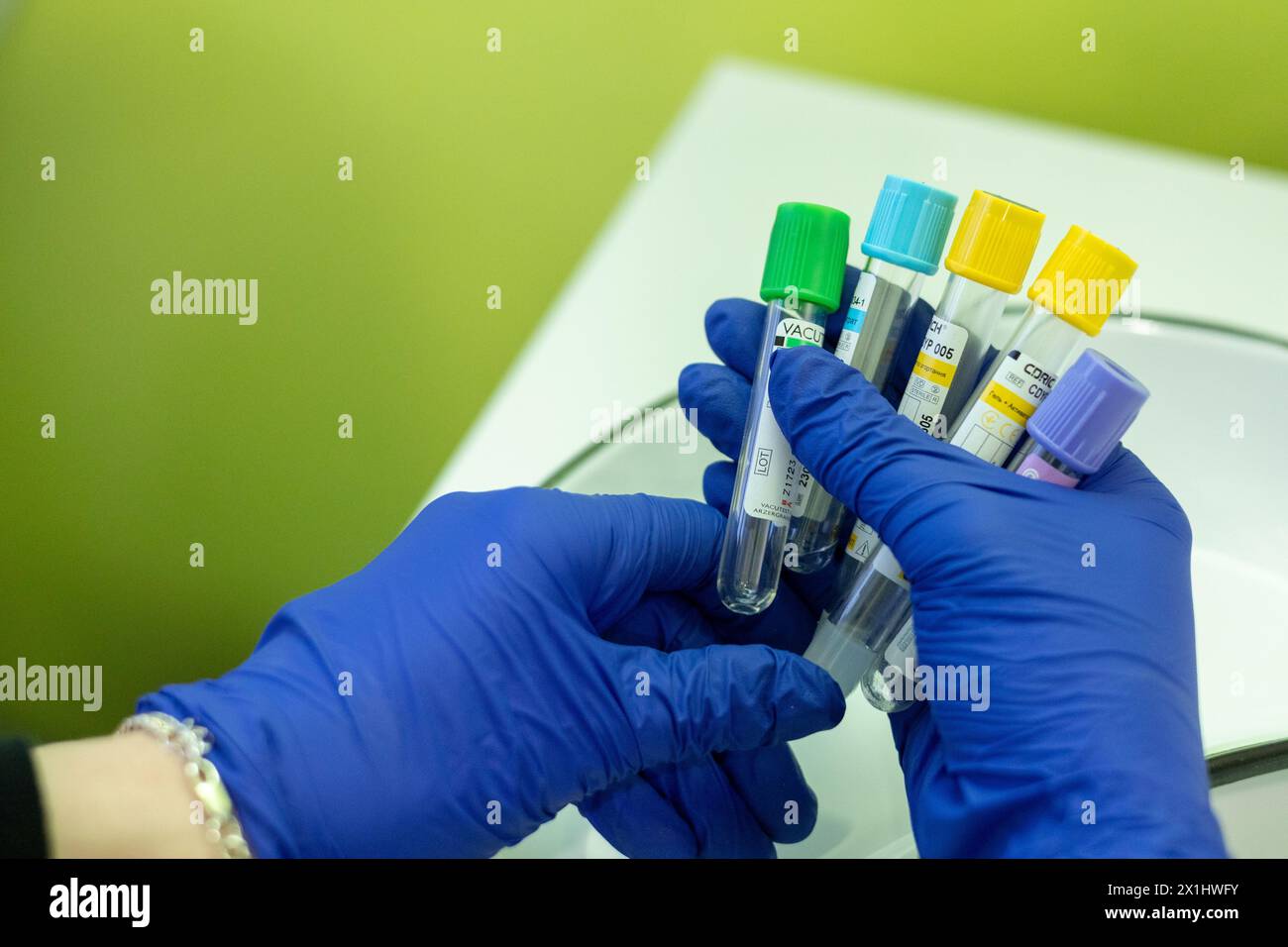 A nurse in blue gloves holds test tubes. Treatment in hospital. Various ...
